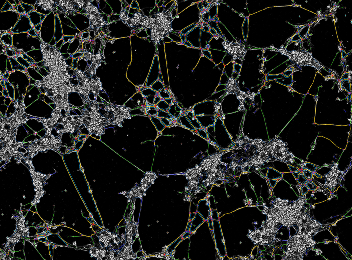 Angiogenesis Analyzer for ImageJ - What's New - Gilles Carpentier ... Angiogenesis Analyzer for ImageJ - What's New - Gilles Carpentier ...